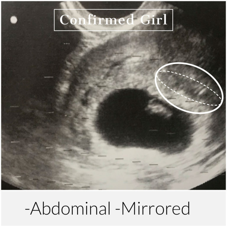 Ramzi Theory Examples - Pictures With The Ramzi Theory