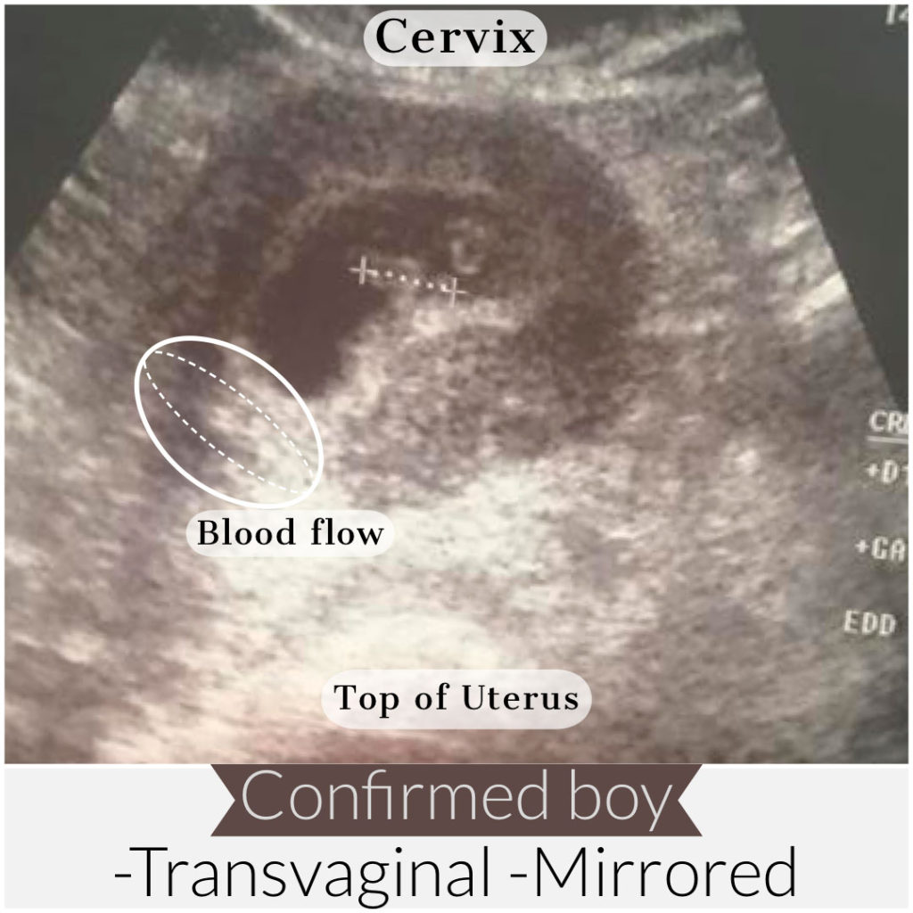 Ramzi Theory Examples - Pictures With The Ramzi Theory