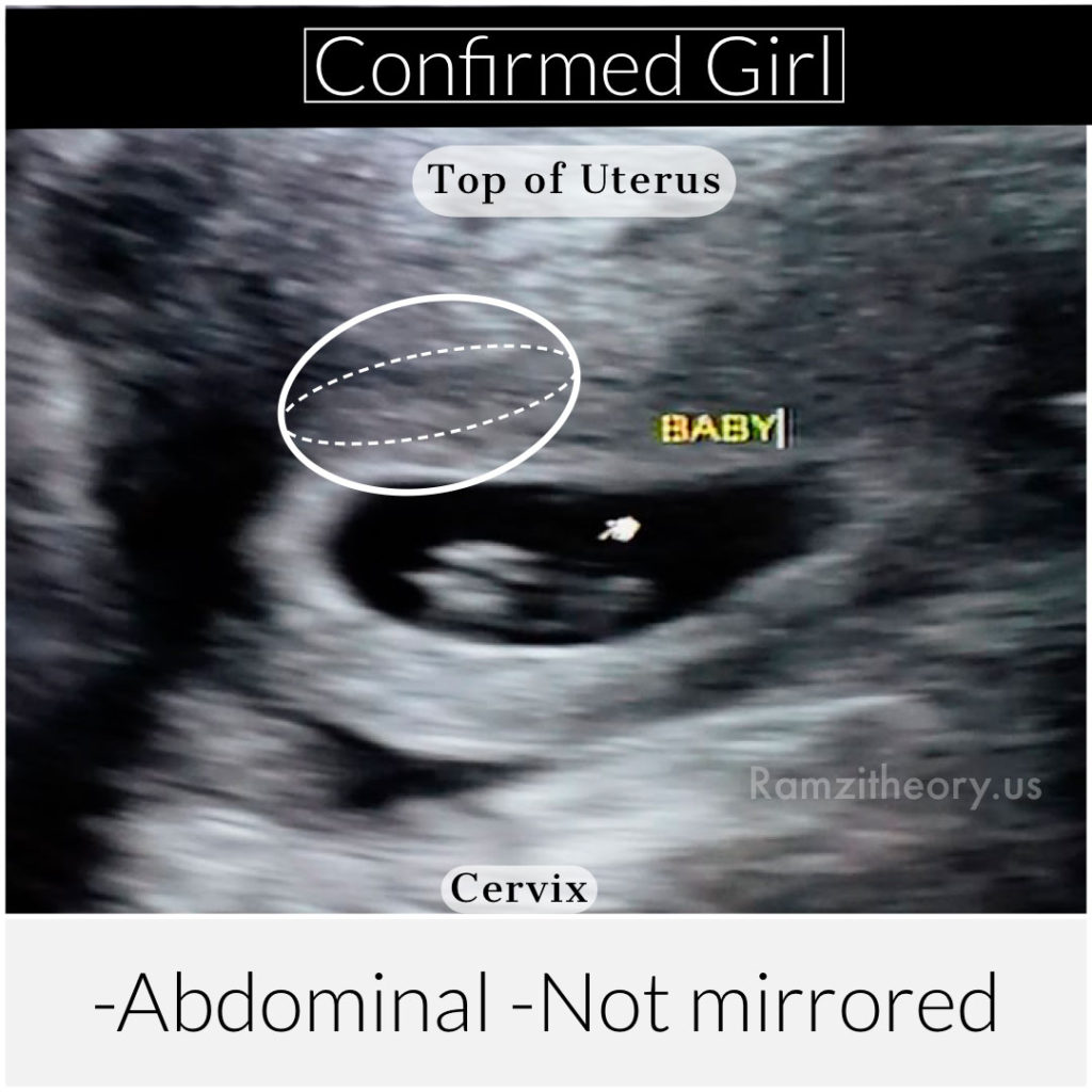 Ramzi Theory Examples - Pictures With The Ramzi Theory