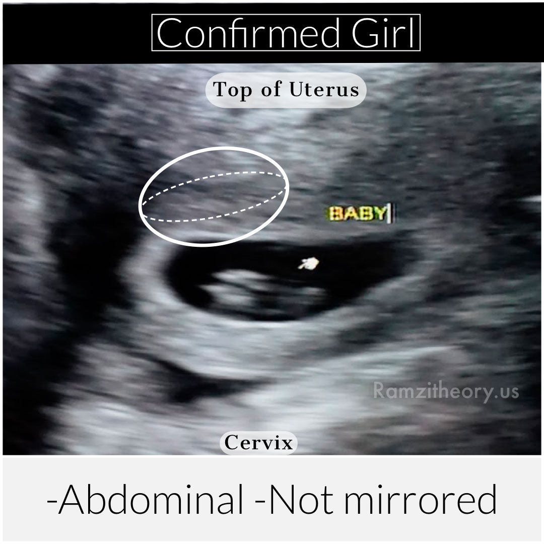 Ramzi Theory Examples - Pictures With The Ramzi Theory