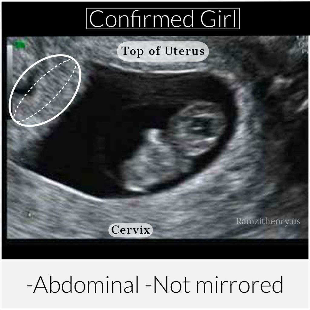 Ramzi Theory Examples - Pictures With The Ramzi Theory