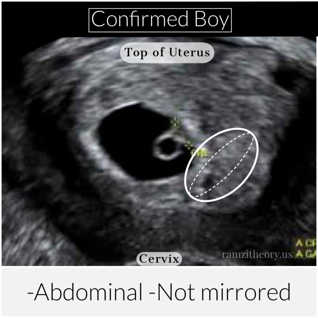 Ramzi Theory Examples - Pictures With The Ramzi Theory
