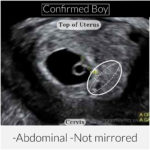 Ramzi Theory Examples - Pictures With The Ramzi Theory