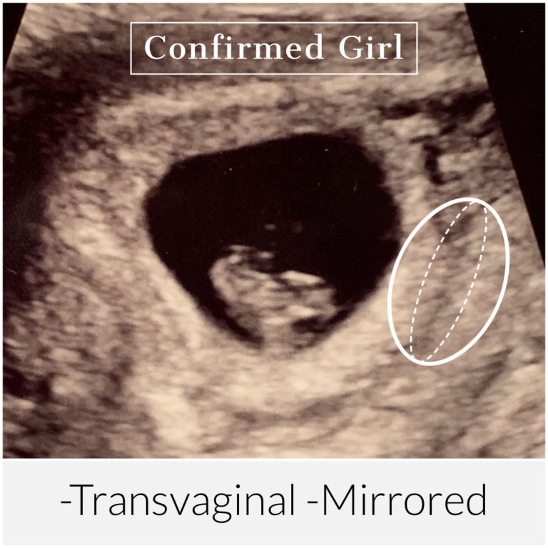 Ramzi Theory Examples - Pictures With The Ramzi Theory