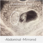 Ramzi Theory Examples - Pictures With The Ramzi Theory