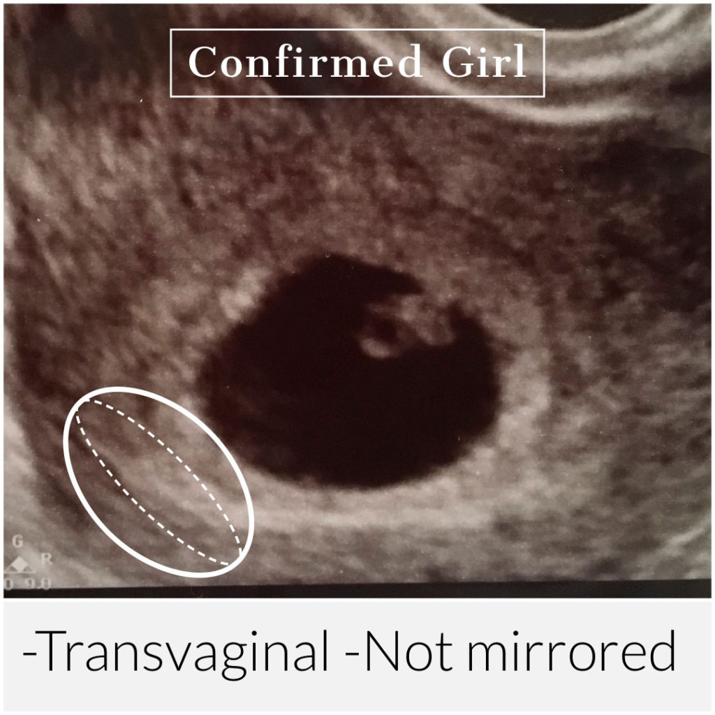 Ramzi Theory Examples - Pictures With The Ramzi Theory