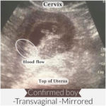 Ramzi Theory Examples - Pictures With The Ramzi Theory