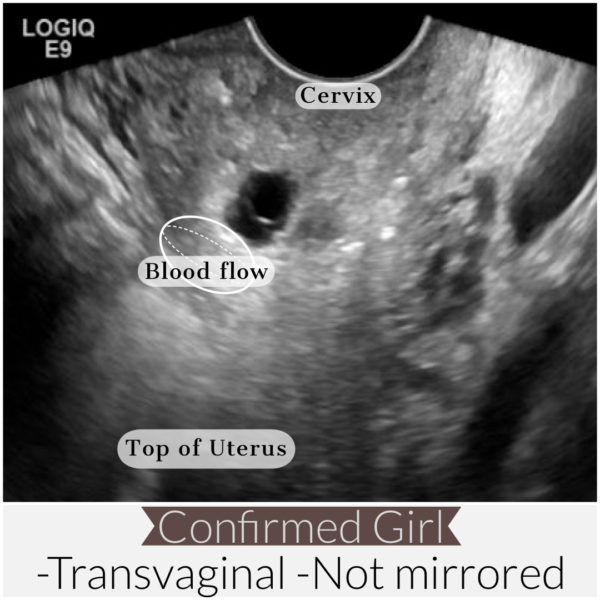 Ramzi Theory Examples - Pictures With The Ramzi Theory